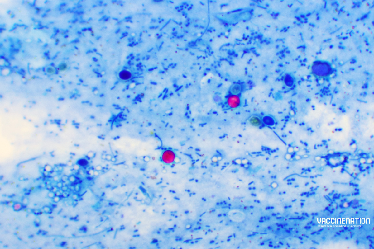 UK cryptosporidium outbreak prompts water concern